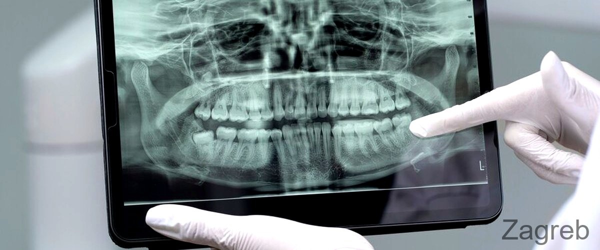 4 najboljih stomatoloških radiologija u Zagrebu